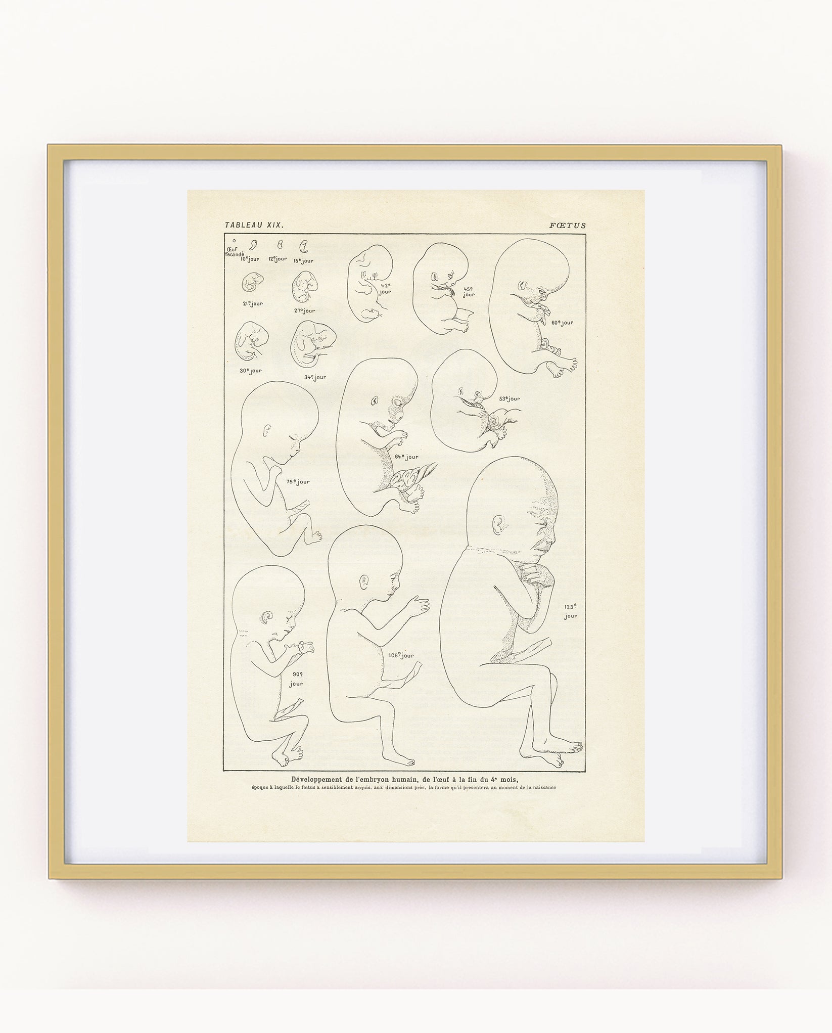 Vintage foetus anatomy poster